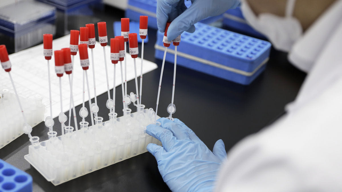 New DNA test designed by Indian firm can detect drug-resistant TB ...